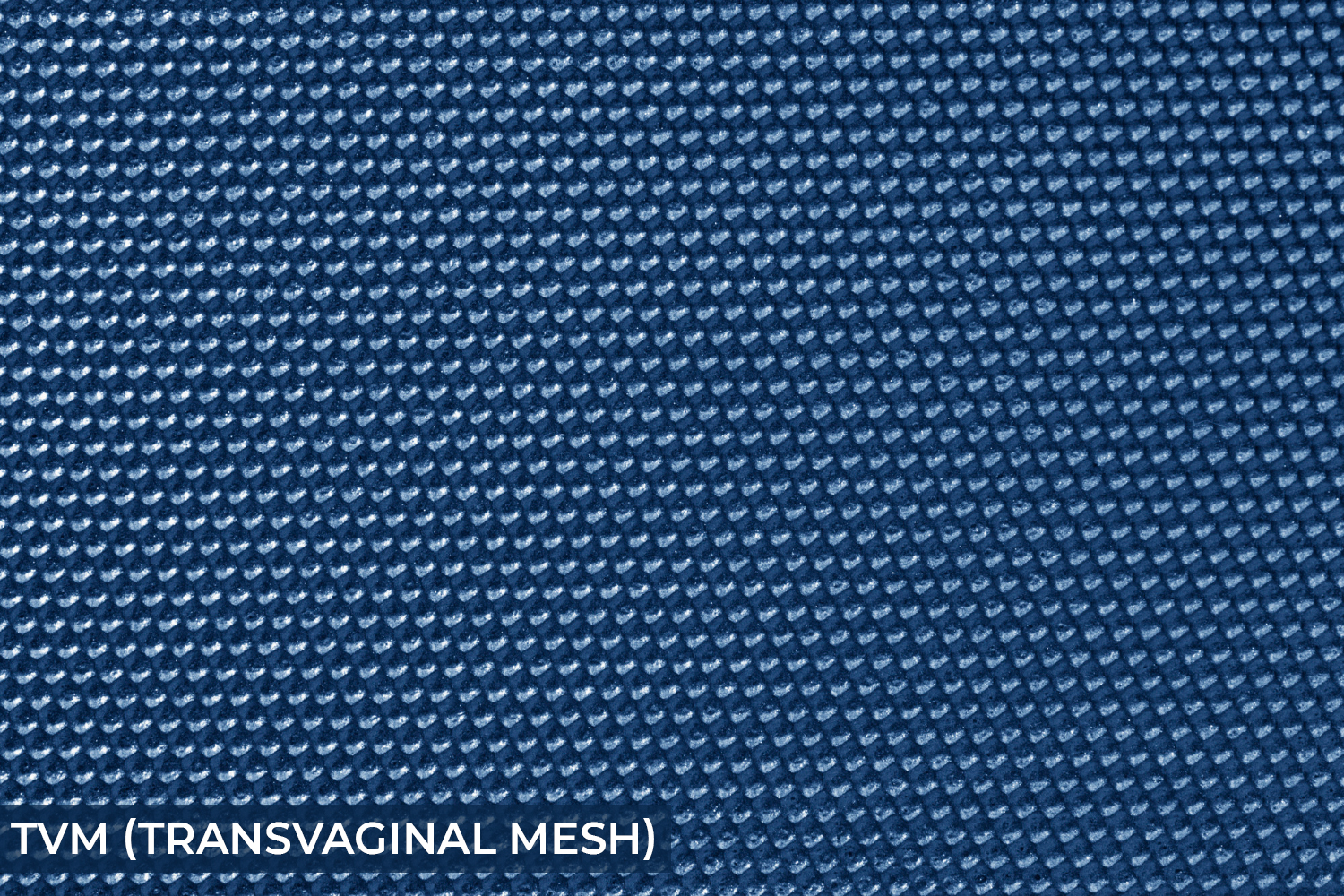 TVM (Transvaginal Mesh) | Neural IT